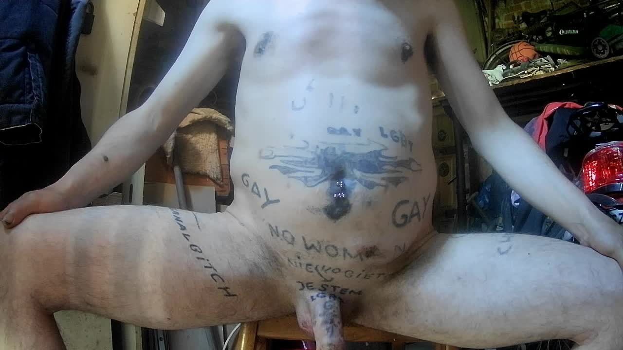 Anal Training And Rectal Prolapse 2